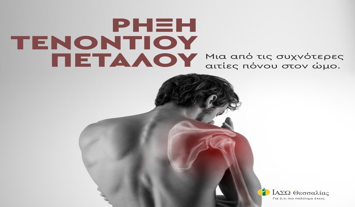 Ρήξη τενοντίου πετάλου: Μια από τις συχνότερες αιτίες πόνου στον ώμο ...