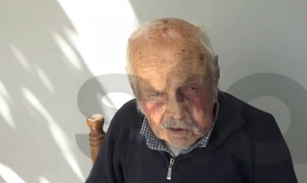 Χαλκίδα: Συγκλονίζει ο 90χρονος που τον ξυλοκόπησαν ληστές για 80 ευρώ ...