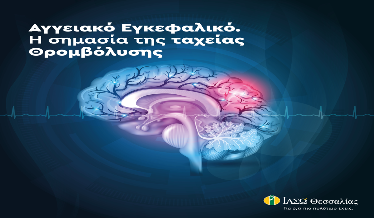 Αγγειακό Εγκεφαλικό Επεισόδιο. Η σημασία της ταχείας θρομβόλυσης ...